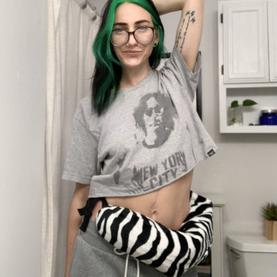 Erythema ab igne (EAI), auch bekannt als Toasted-Skin-Syndrom – YUYU EU